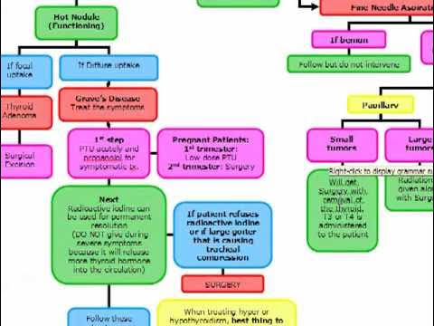 USMLE ALGORITHMS: Thyroid Nodule - YouTube