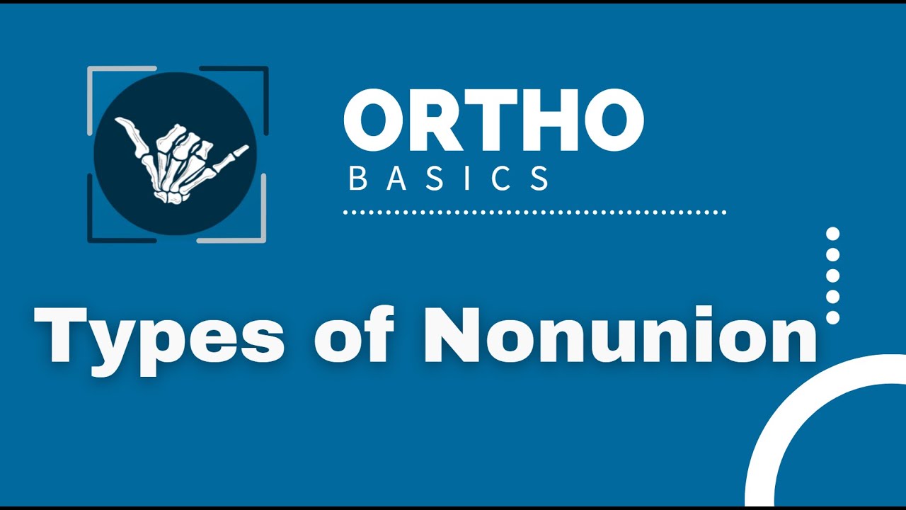 Ortho Basics: Types of Nonunion - YouTube