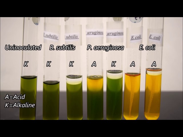 IMViC Test- Principle, Result Chart, Examples, Uses, 60% OFF IMViC Test- Principle, Result Chart, Examples, Uses, 60% OFF