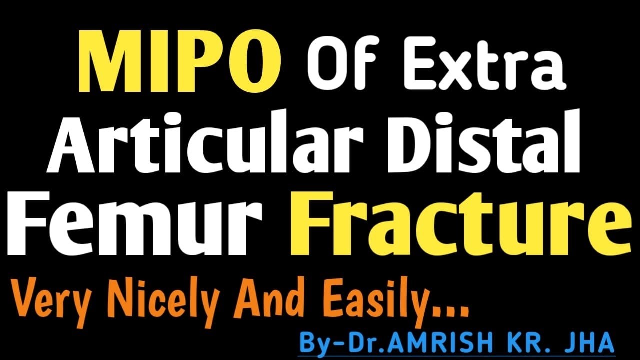 MIPO of distal femur extra articular fracture by Dr. Amrish Kumar Jha ...