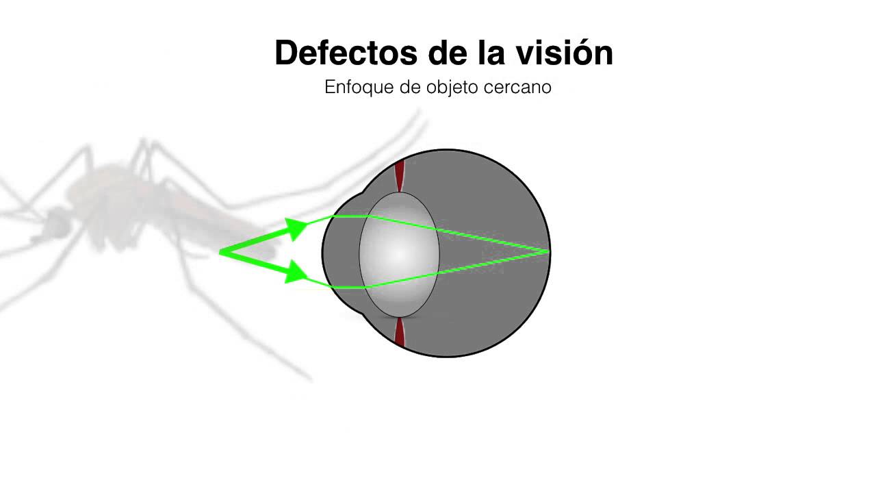 FS 210 Biofísica Defectos de la visión - YouTube