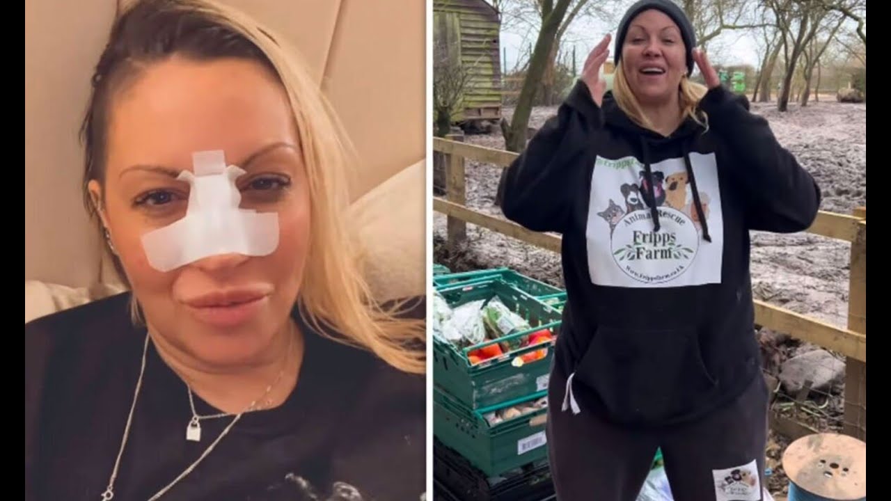 Jodie Marsh badly bitten on face by exotic animal and left with painful ...