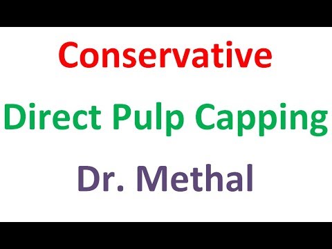 Conservative - Direct Pulp Capping - Dr. Methal - YouTube