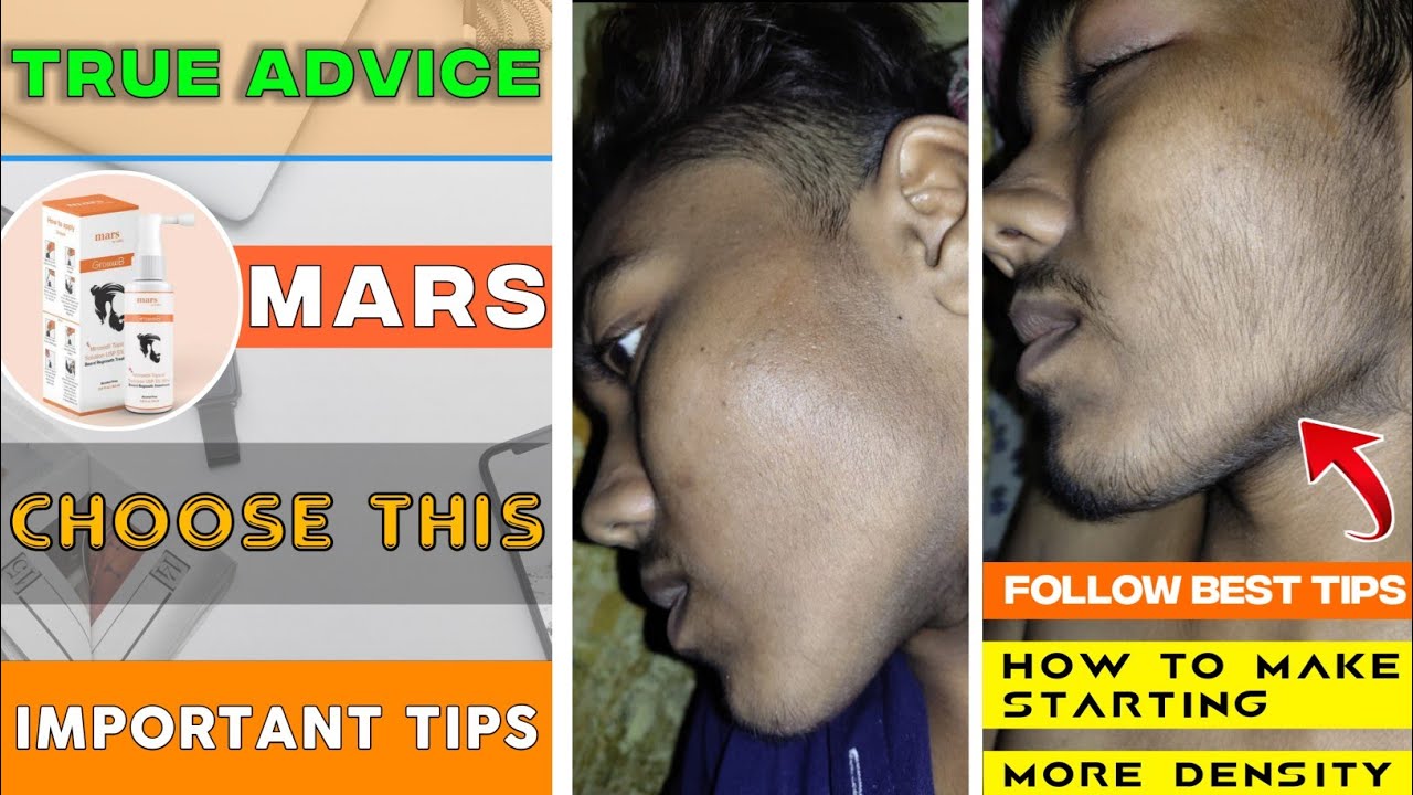 BEARD GROWTH || Follow best tips for fast beard growth || How to make ...