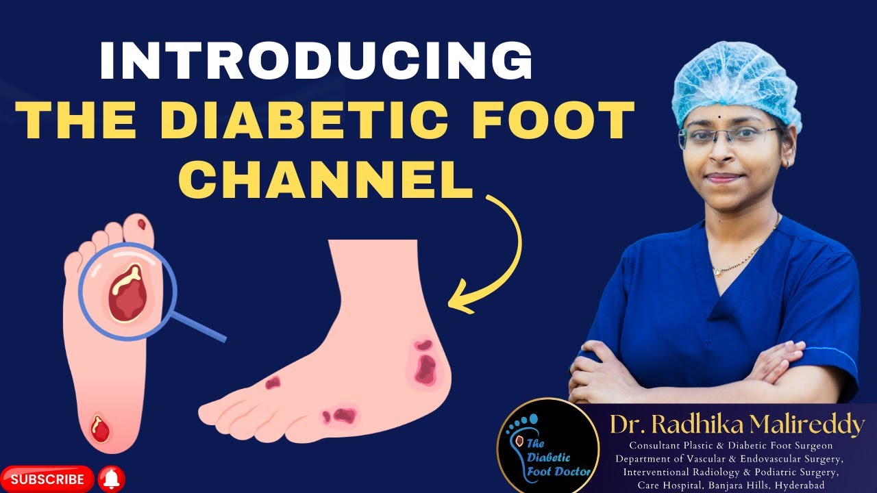 Introducing the Diabetic Foot Channel | Diabetic Foot | Dr. Radhika ...