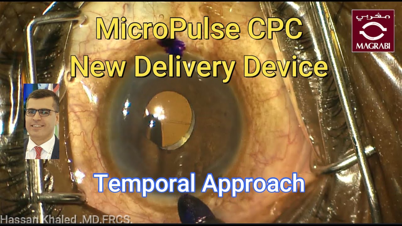 MicroPulse CPC , New Delivery Device And Temporal Approach - YouTube