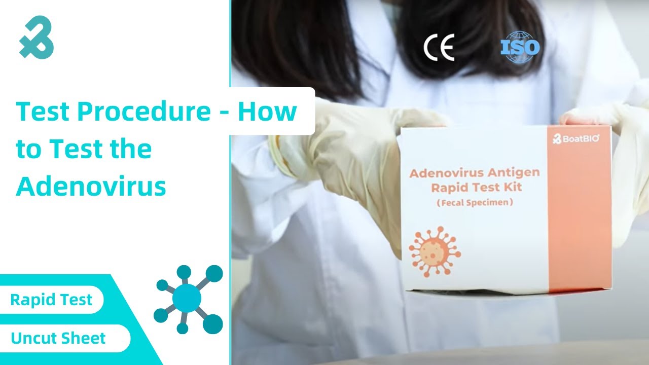 Test Procedure - How to Test the Adenovirus - YouTube