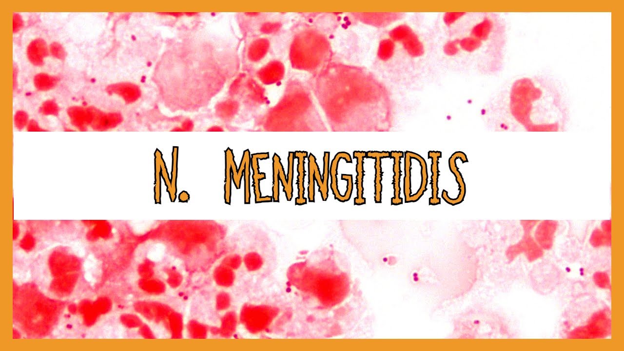 Neisseria Meningitidis - YouTube
