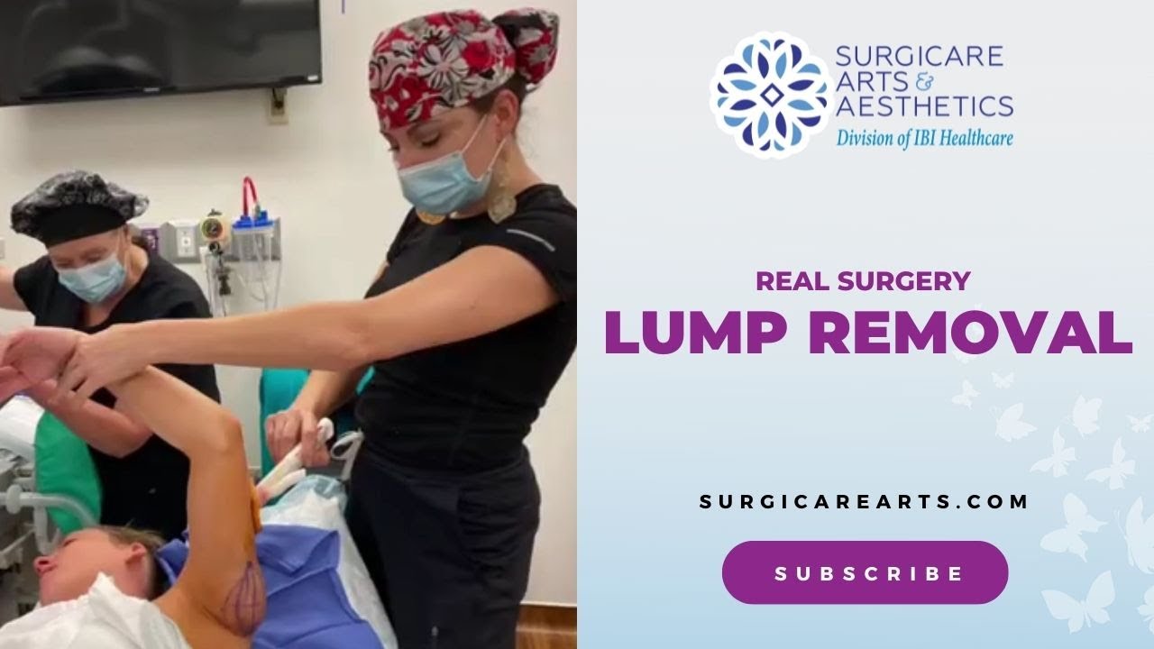 Real Surgery - Lump Removal - SurgiCare Arts & Aesthetics - YouTube