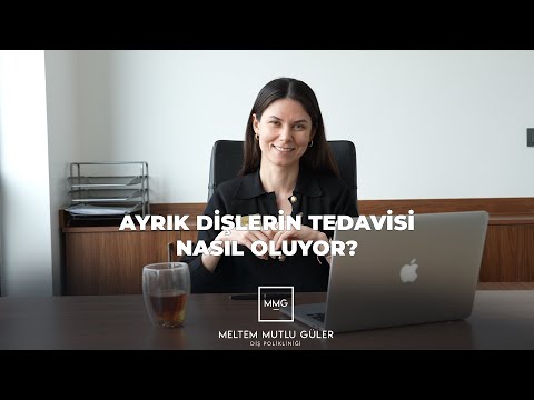 Ayrık Diş Tedavisi Nasıl Olur?