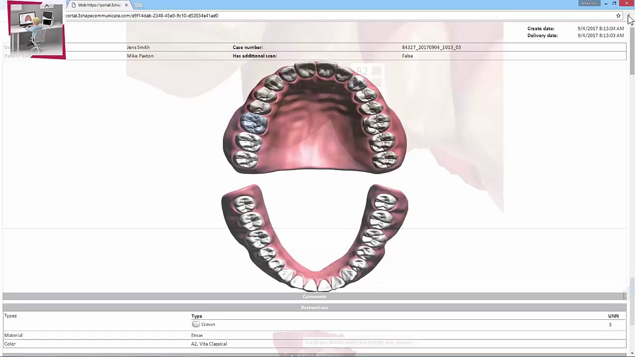 3Shape Communicate - 3Shape Communicate を使って歯科医院と技工所間でコミュニケーションをとる方法 ...