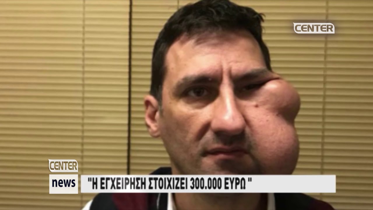 Ο Θ ΣΥΡΟΠΟΥΛΟΣ ΖΗΤΑ ΒΟΗΘΕΙΑ ΓΙΑ ΤΟ ΣΟΒΑΡΟ ΠΡΟΒΛΗΜΑ ΥΓΕΙΑΣ ΤΟΥ - YouTube