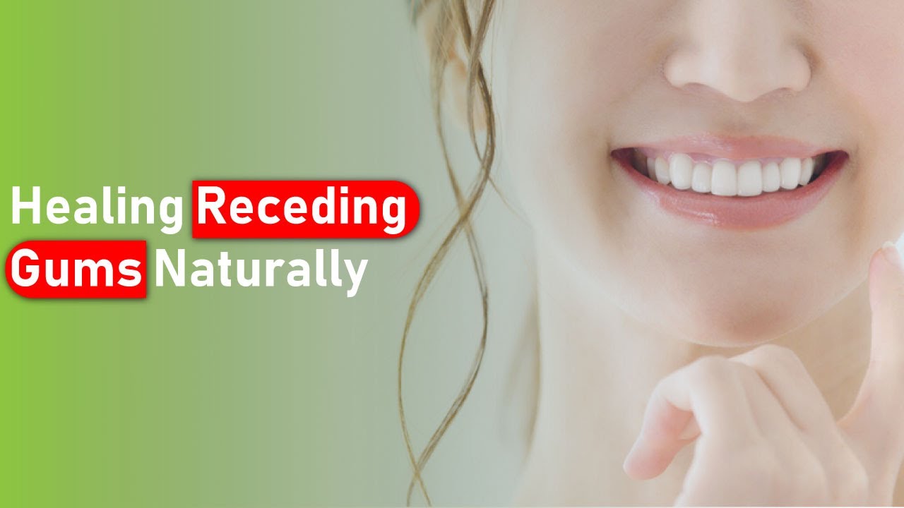 Heal Gums - At Home Remedy For Healing Receding Gums Naturally - YouTube