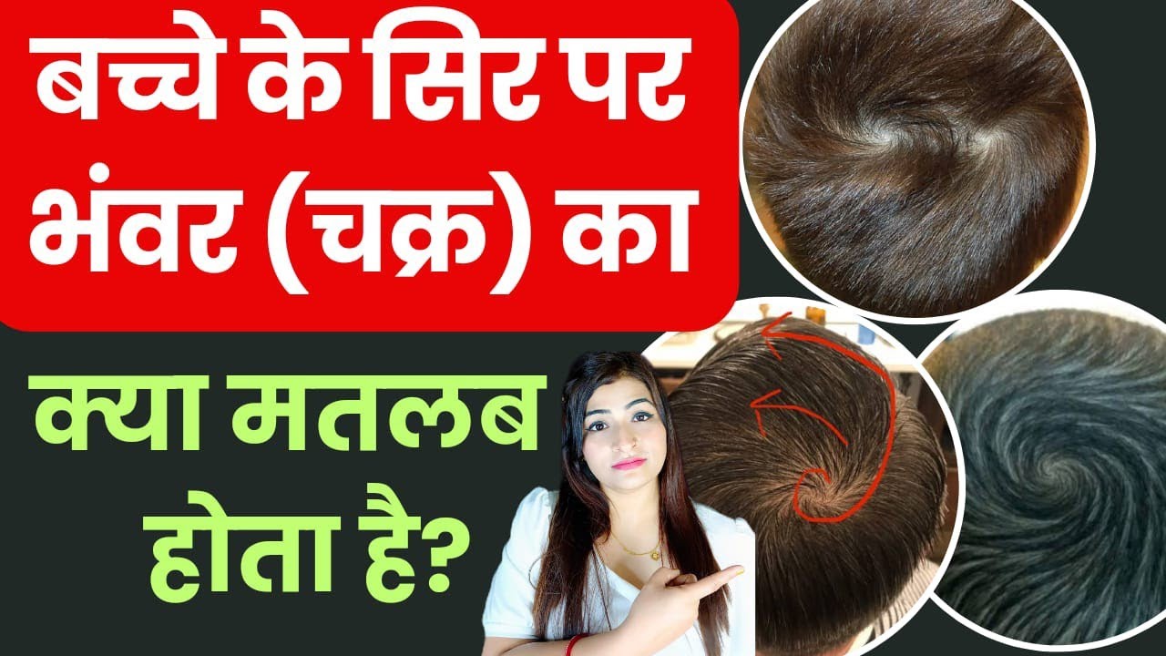 बच्चे के सिर पर भंवर या चक्र क्या होते है | इसके होने के क्या कारण है ...