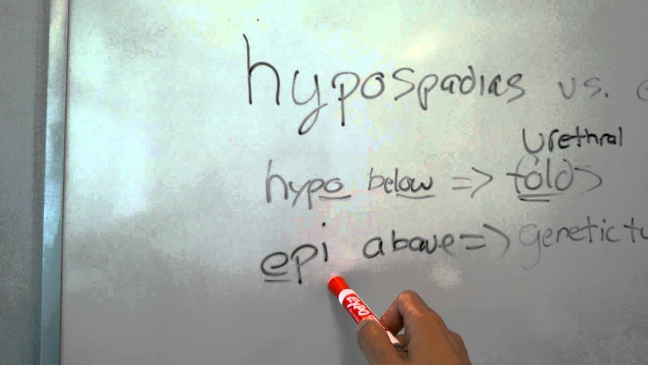 USMLE Embryology Epispadias vs Hypospadias - YouTube