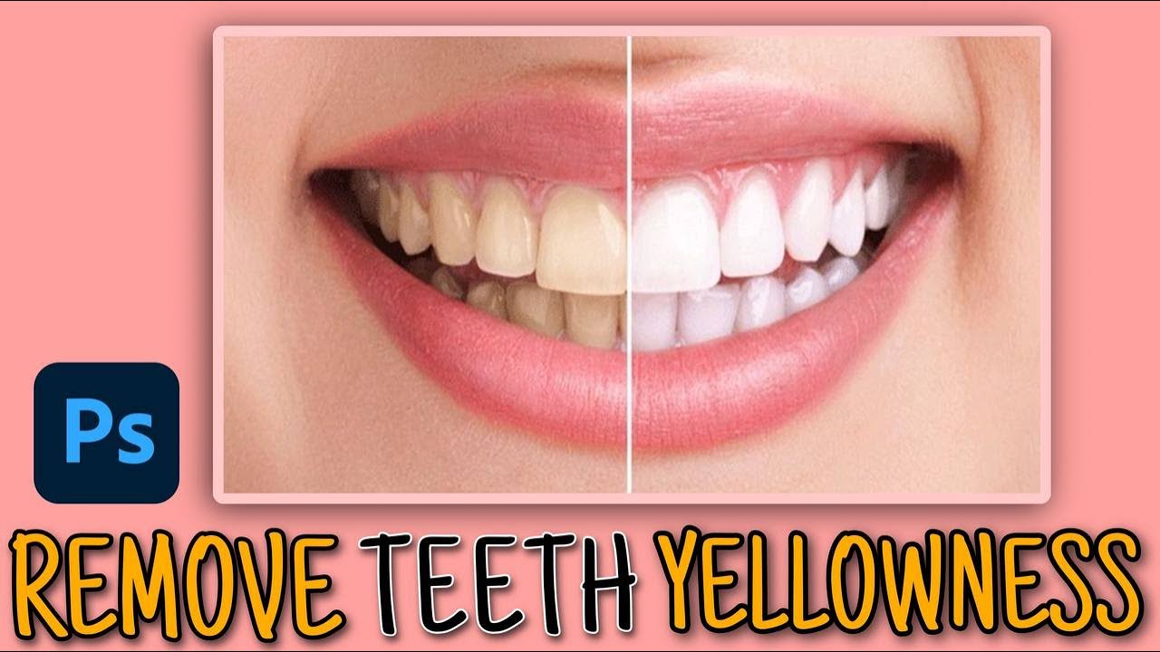 How To Remove Yellowness In Photoshop - Fast and Easy - YouTube