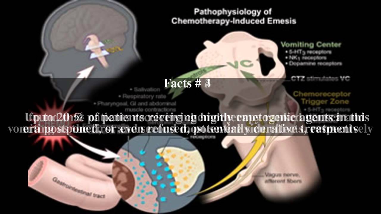 Chemotherapy-induced nausea and vomiting Top # 5 Facts - YouTube
