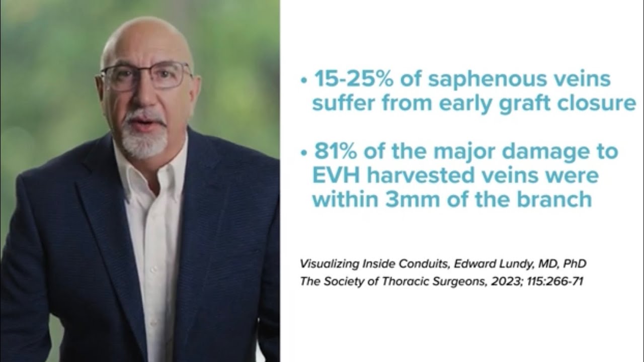 Evolution of EVH Technology and Techniques using the Saphena Venapax ...