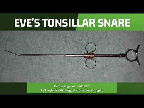 EVE, TONSILLAR SNARE - YouTube