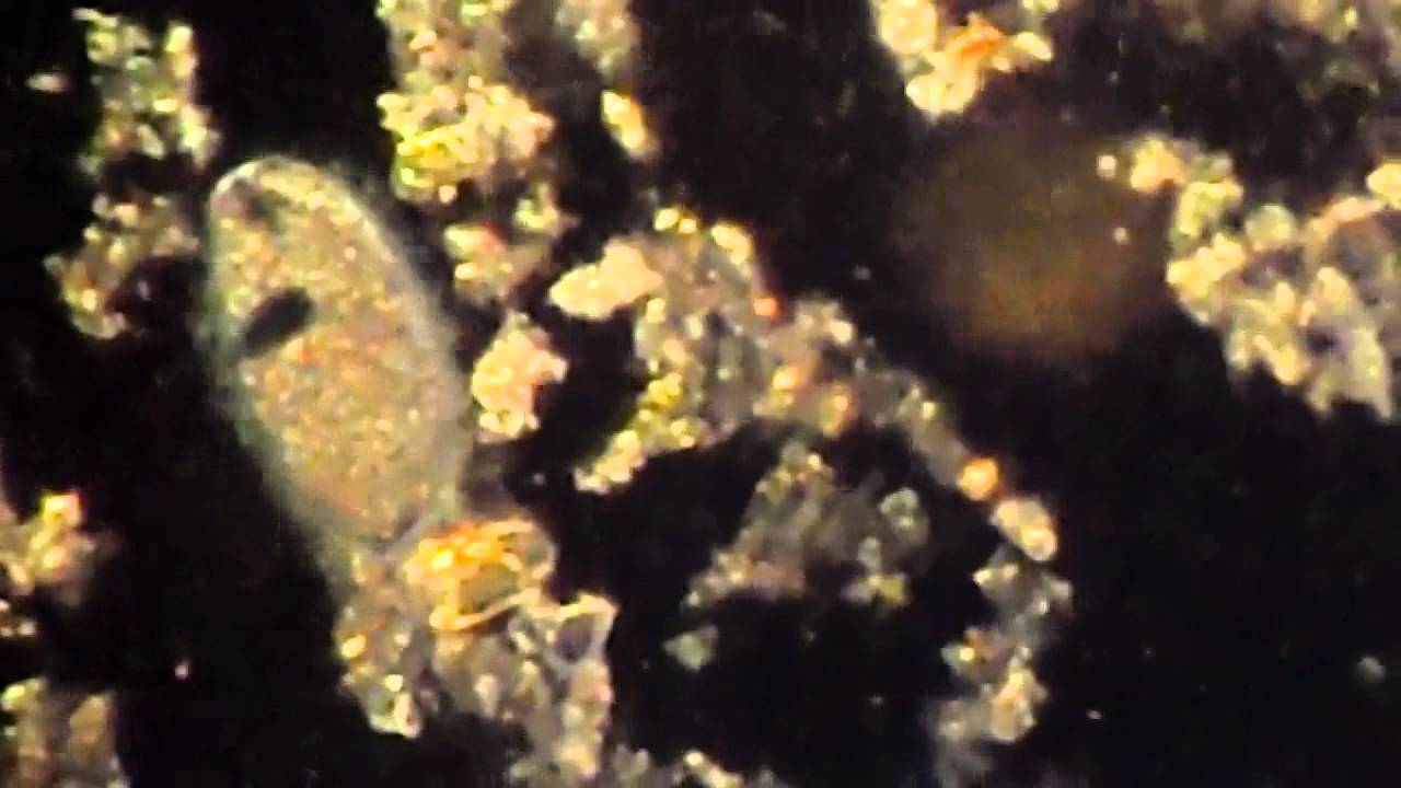 Cow Stomach Rumen Fluid- Under Microscope (Dark Contrast) - YouTube