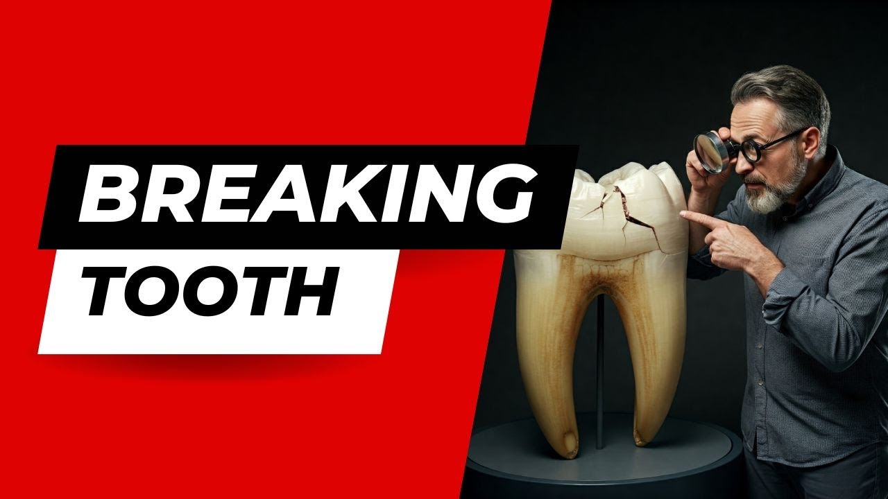 The SHOCKING Truth About Tooth Decay! 🦷 (You WON'T Believe This!) - YouTube
