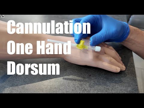 Cannulation - One Hand Technique - Dorsum of the Hand - YouTube