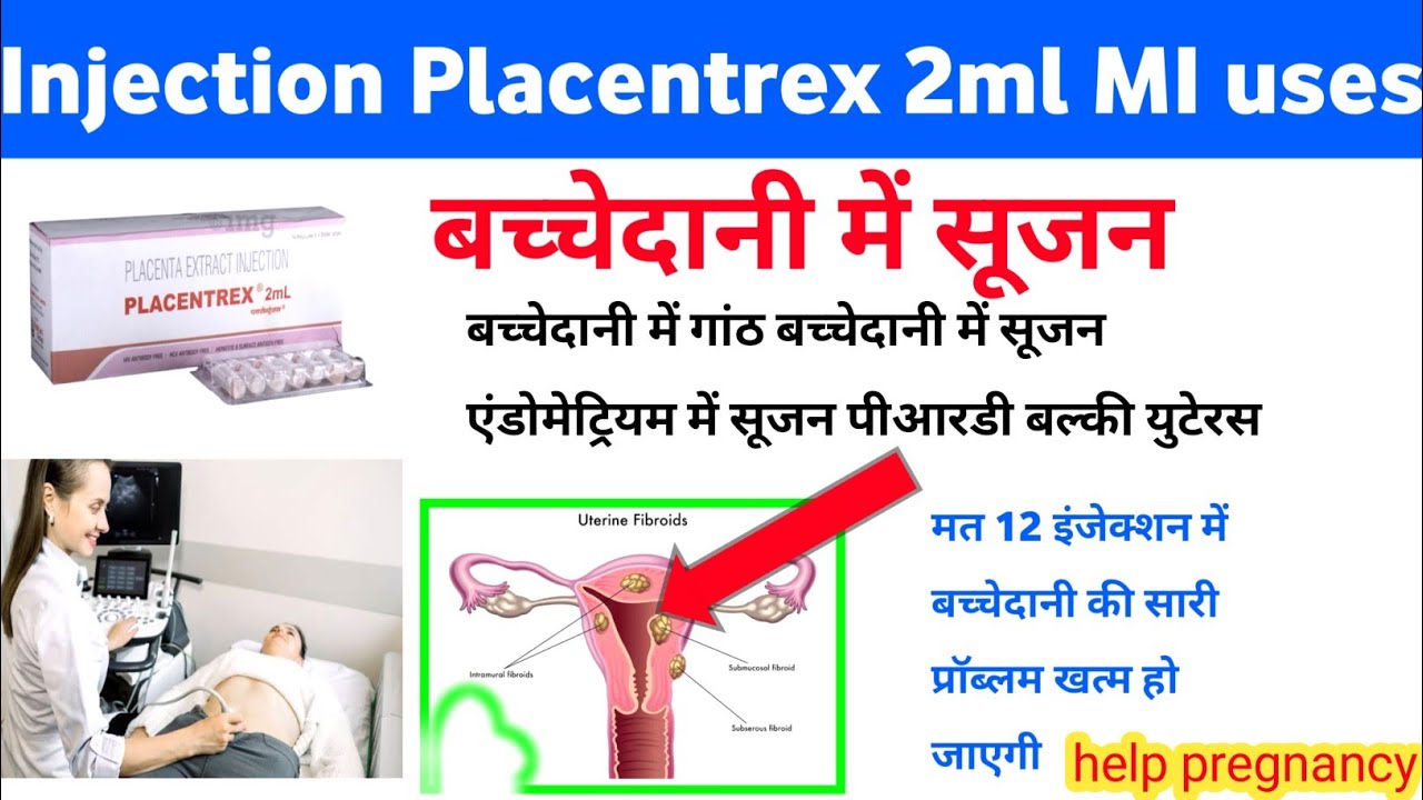 Placentrex Injection uses or side effects । Placentrex helf pregnancy ...
