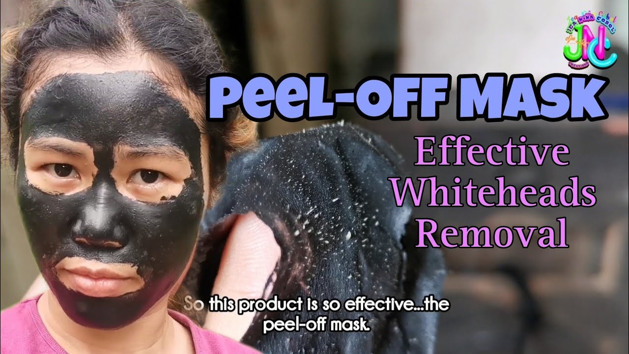 Effective Whiteheads Removal Using Peel-Off Mask | Disgusting Matter ...