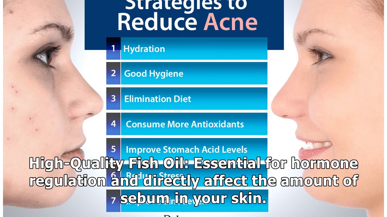 The Acne Candida Diet | Food Effects On Acne - YouTube