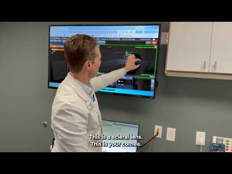 How Do Scleral Lenses Work? Fitting for 20/20 Vision Explained