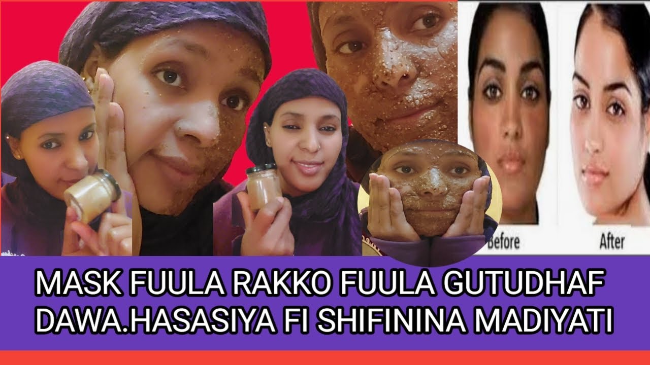 Michi fuula shifinina madiyati #Rakkina gurracha ija jala guutu rako ...