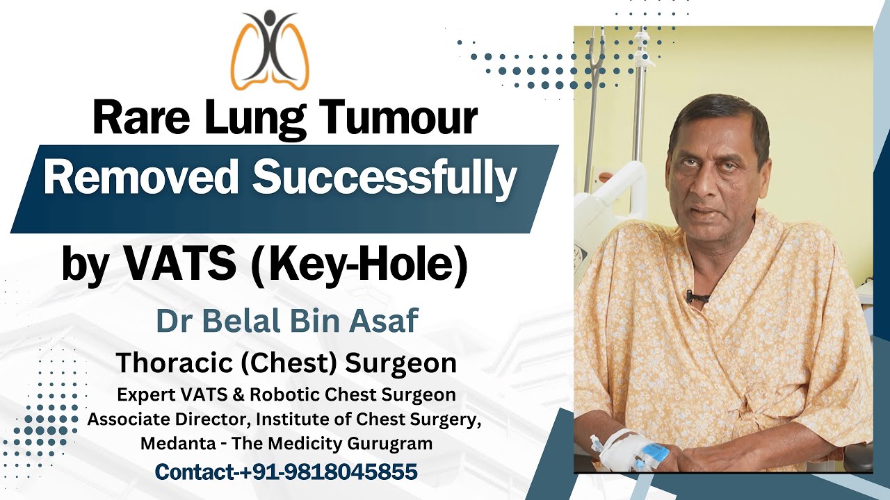 "Frequent Hiccups Reveal Rare Lung Tumor | VATS Wedge Resection Success ...