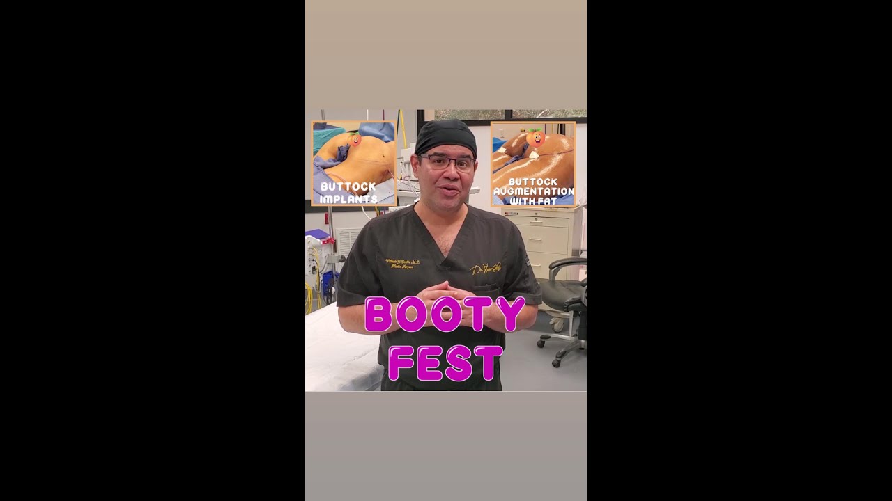 Booty Fest: Buttock Augmentation w/ Fat vs Buttock Implants - YouTube