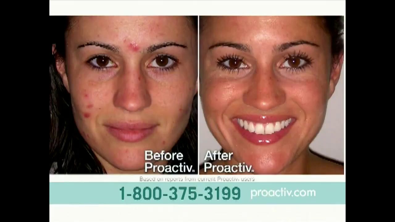 Proactiv TV Commercial, 'Acne Fact' - YouTube