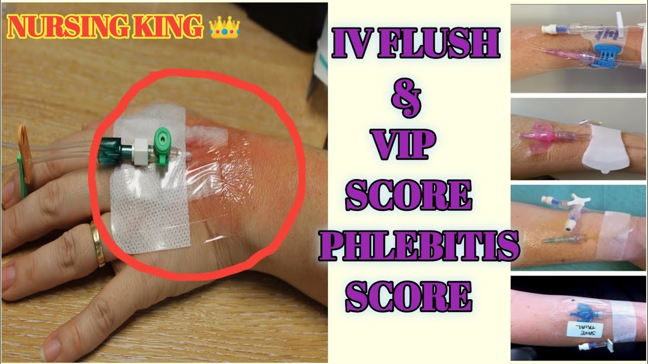 Visual Infusion of Phlebitis ( VIP ) Score।। PHLEBITIS SCORE । VIP ...