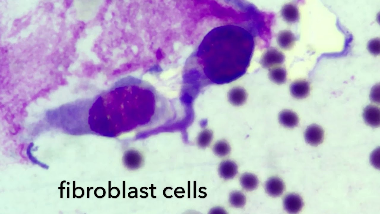 Fibroblast cells - YouTube