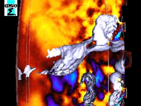 Flame front propagation of the ignition of a full helicopter combustor ...
