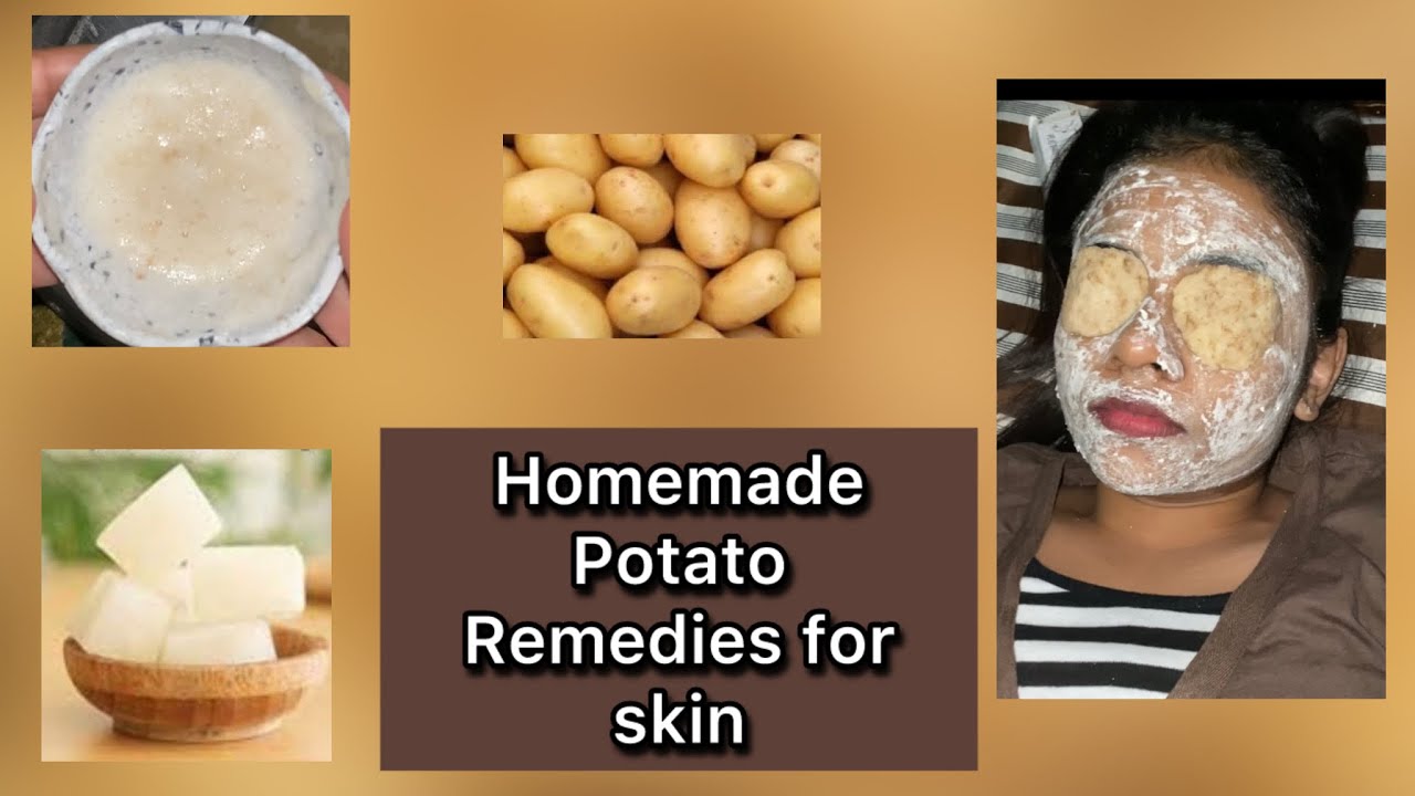Potato remedies for dark spots and sun tan | Homemade solution for ...