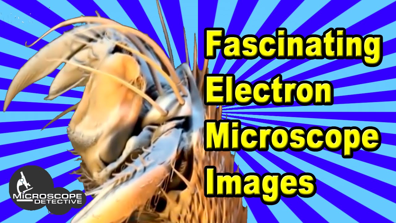 Electron Microscope Images: Explore the World in Miniature with a ...