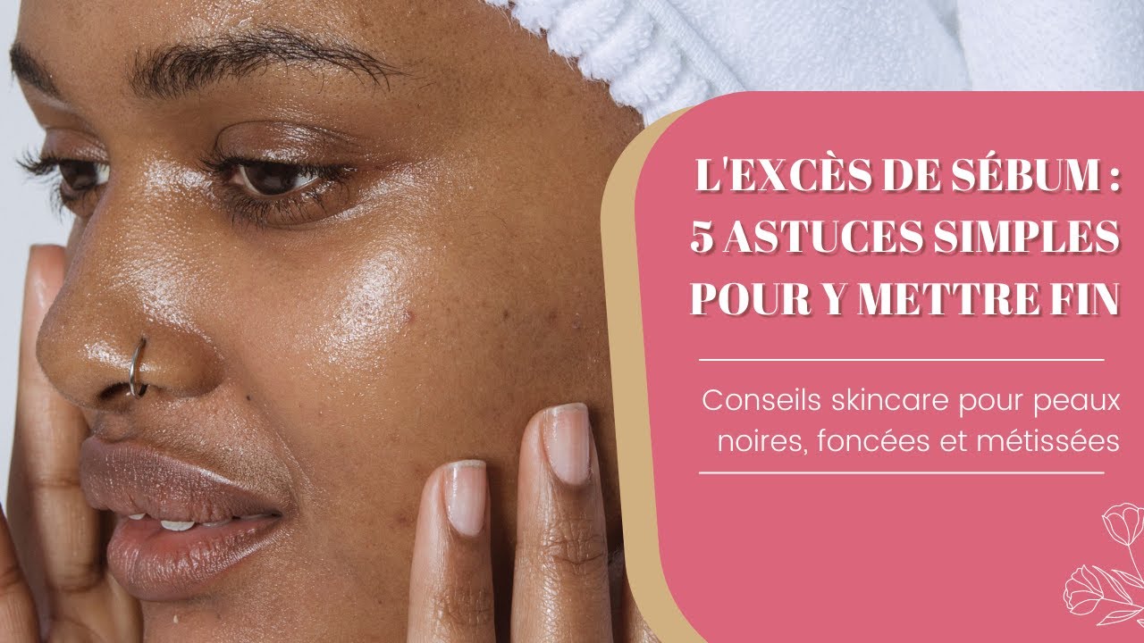 5 astuces simples pour mettre fin à l'excès de sébum - YouTube