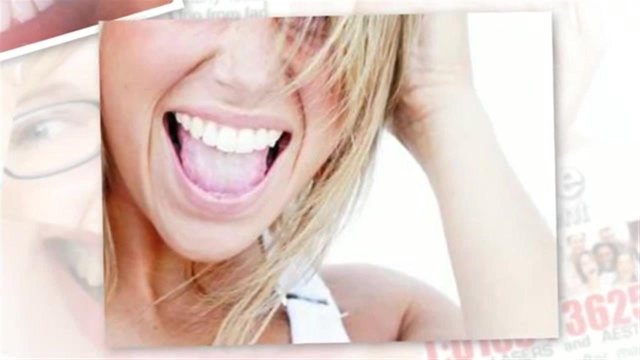 Clark Teeth Whitening - YouTube