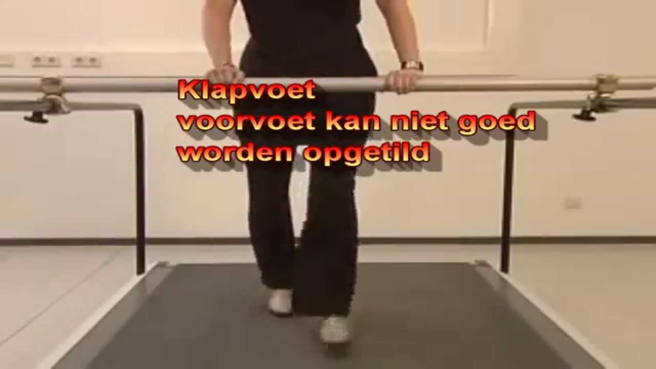 klapvoet - YouTube