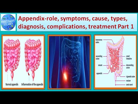 Appendix role, Symptoms, causes, types, Risk factor, diagnosis ...