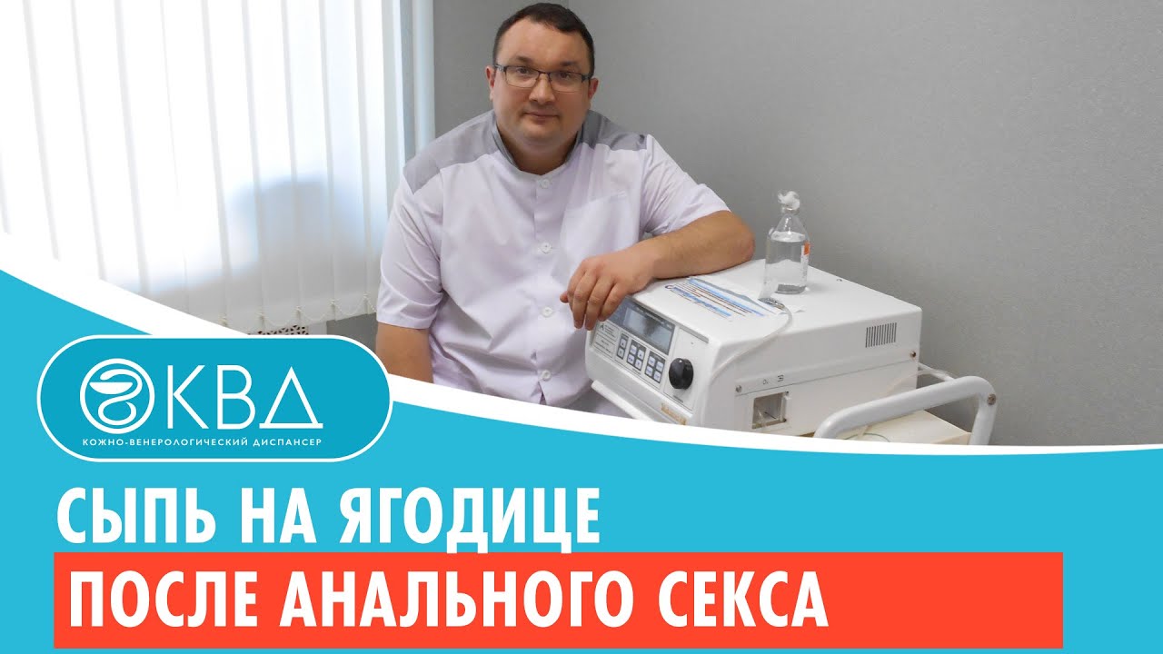 😲 Сыпь на ягодице после анального секса. Клинический случай №518 - YouTube