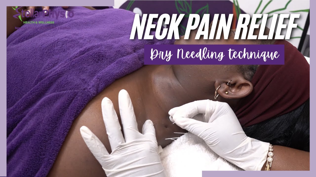 Chronic Neck Pain GONE! The Dry Needling Secret for LASTING Relief (It ...