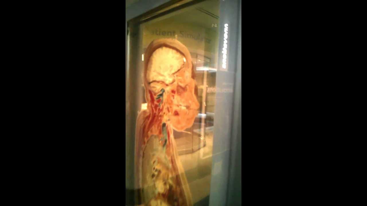 Body slices Museum of Science and Industry - YouTube