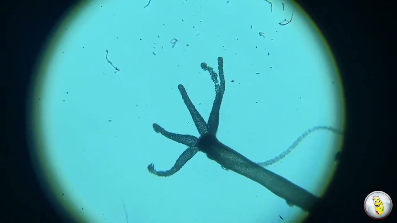 The Amazing Hydra Tiny, Tentacled, Toxic - YouTube
