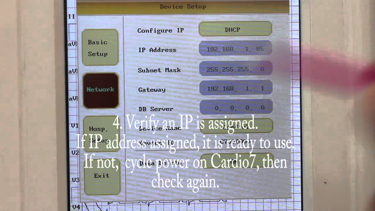Bionet Cardio7 to EKG Plus II software, ECG Viewer - YouTube