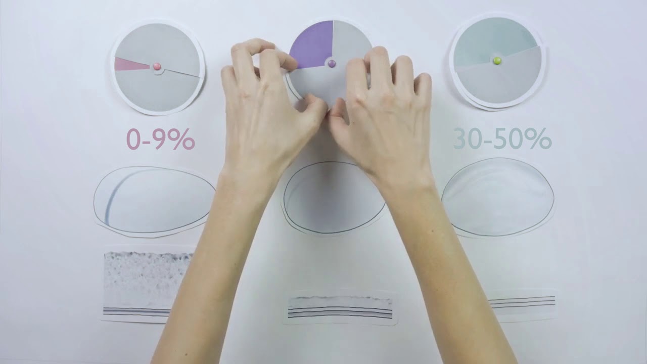 The history of the breast implants. When were they created for the ...