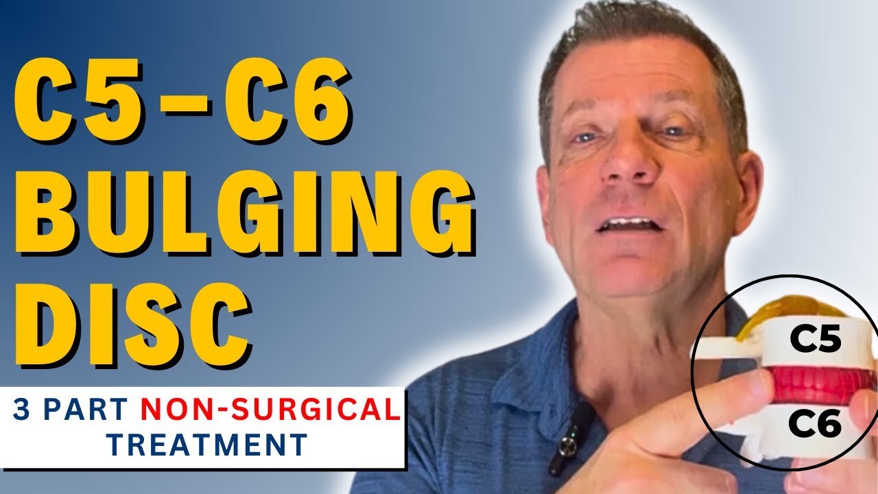 C5 C6 Disc Bulge (Bulging Disc) 3 Step Treatment Without Surgery | Dr ...